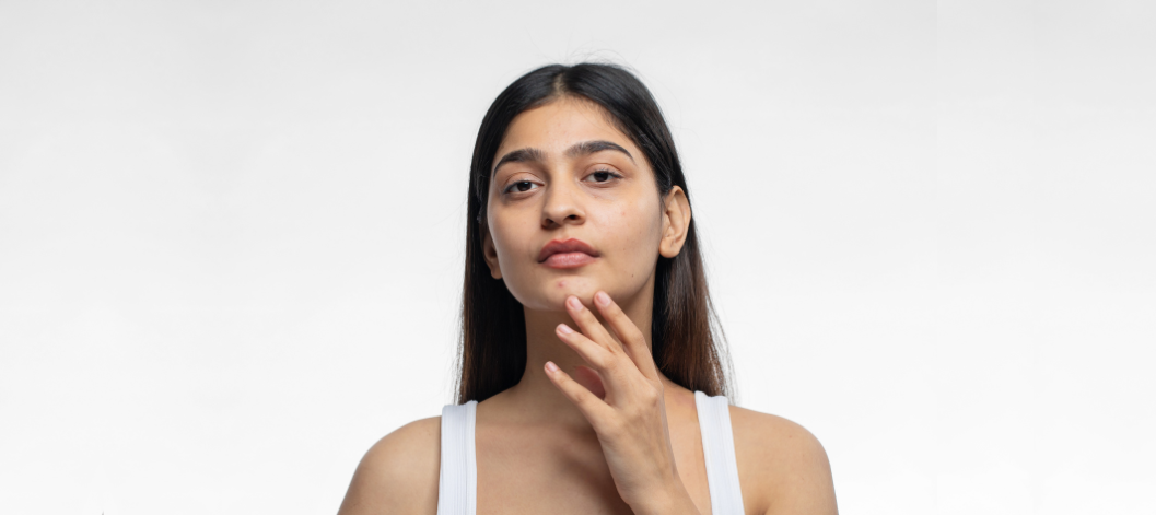 Is sugar really bad for your skin? Can it cause acne? – Re'equil
