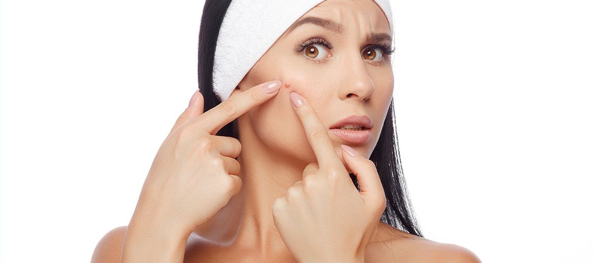 Why Is Popping Pimples Bad for Your Skin? – Re'equil