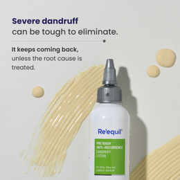 Anti-Recurrence Dandruff Lotion For Severe, Greasy, Flaky Dandruff – Re ...