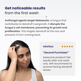 Anti-Recurrence Dandruff Lotion For Severe, Greasy, Flaky Dandruff – Re ...