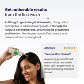 Anti-Recurrence Dandruff Lotion For Severe, Greasy, Flaky Dandruff – Re ...