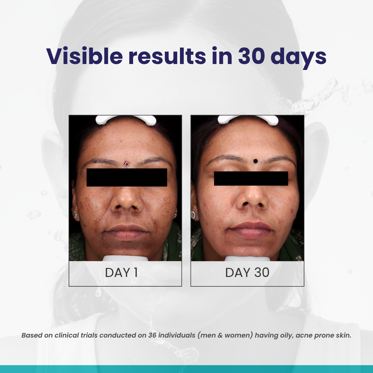 Buy Oil Control & Anti Acne Face Wash Online - Re'equil